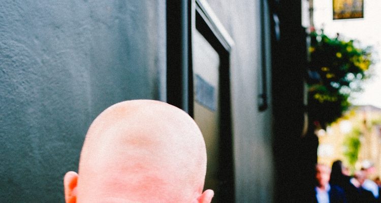 Are bald men walking solar panels? | Innovators magazine